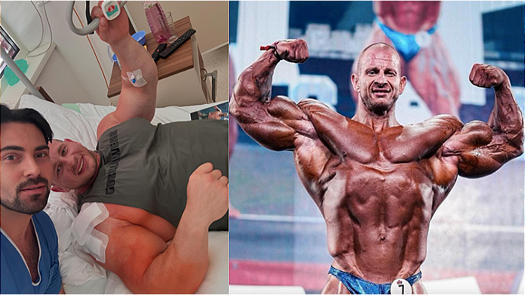 Krizo EVLS Prague Surgery - colosseumstrength.com